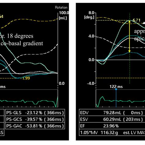 Differences Between Apical And Basal Left Ventricular Rotations In The