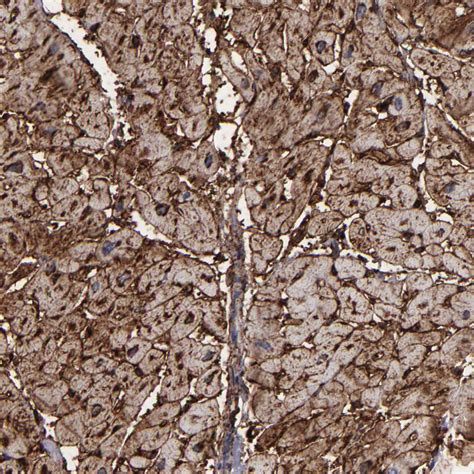 Rabbit Polyclonal Anti Cd36 Antibody Buy For Research Highly Specific Rigorously Validated