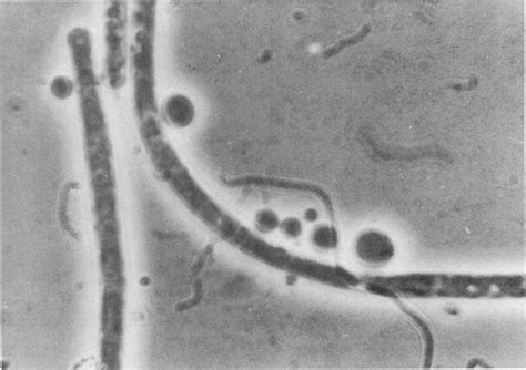 Photomicrograph Of Phormidium Sp Strain J 1 With N Hexadecane
