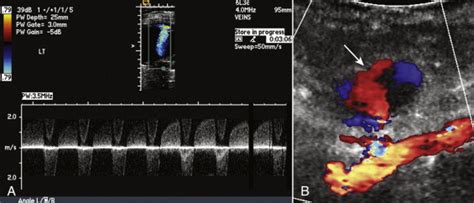 Noninvasive Vascular Imaging Clinical Tree