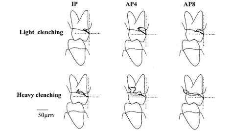 Tooth Displacement Paths In The Frontal Plane Of A Japanese Subject