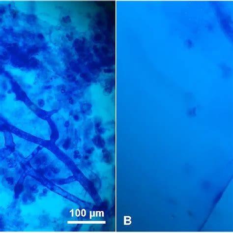 Direct Microscopy Of A Faecal Sample New Methylene Blue × 1000 A