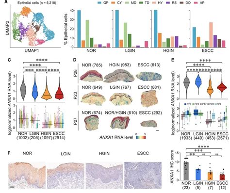 项目文章丨cancer Cell：单细胞时空多组学揭示上皮细胞激活成纤维细胞促进食管癌发展 知乎