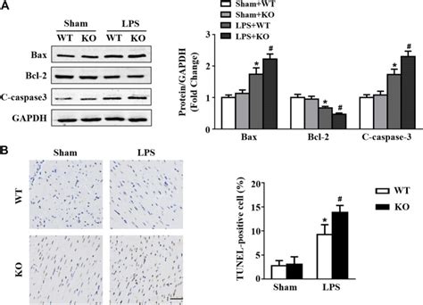 Il12a Deletion Aggravates Sepsis Induced Cardiac Dysfunction By