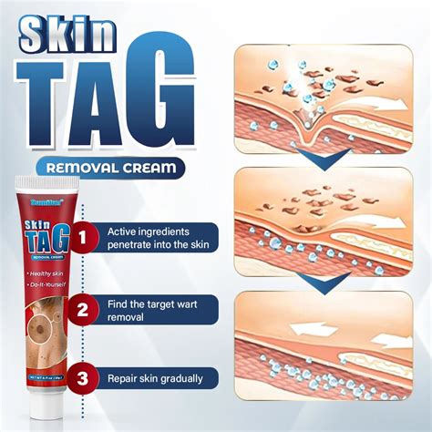 Seagril Concentrated Potent Skin Tag Removal Cream