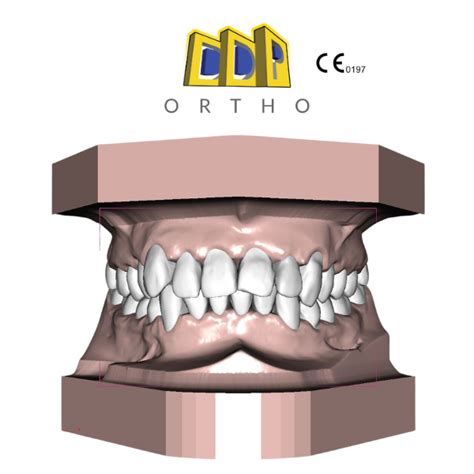 Digital Diagnostic Models Polorto