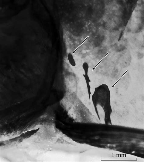 Multiple Ossification Centers Marked By Arrows In The Postcleithrum Download Scientific