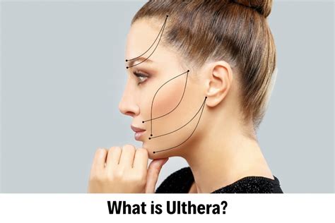 Ulthera Unisa Health Turkey