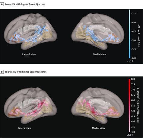 Tract Based Spatial Statistical Analysis In The Left Hemisphere Download Scientific Diagram