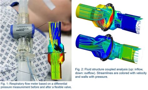 Erke Wang On Linkedin Study Of A Respiratory Flow Meter