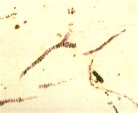 Bacteriology Test 2 Flashcards Quizlet