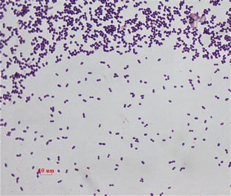 Enterococcus Spp