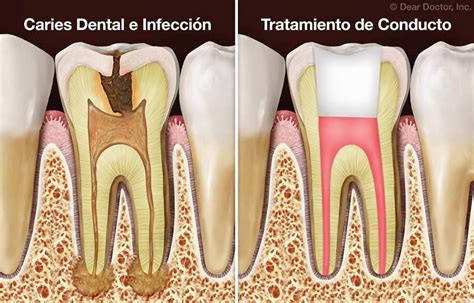 Patient Education Austin Tx Advanced Smiles Dental