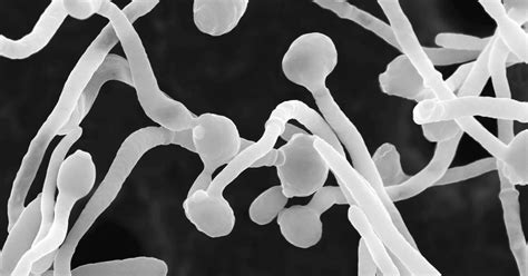 Unruly Gut Fungi Can Make Your Covid Worse WIRED