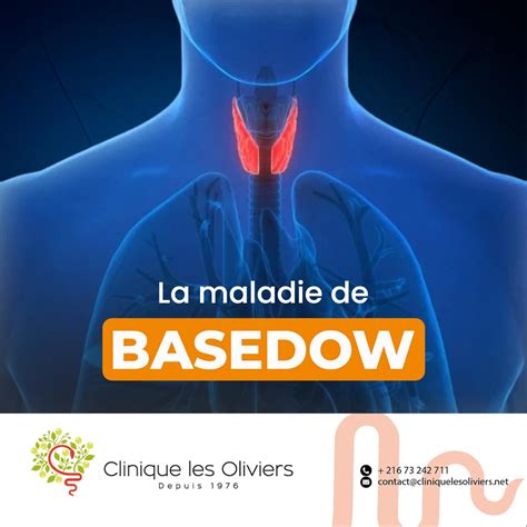 Clinique La Maladie De Basedow Définition La Maladie De Basedow Ou