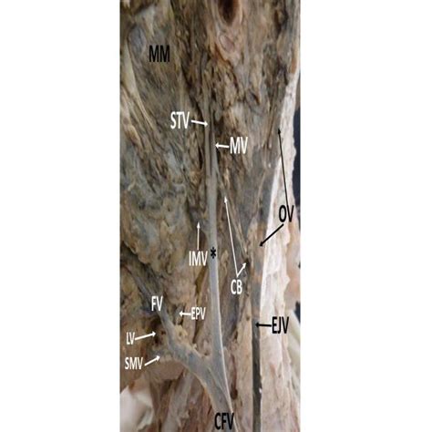 Left Side Of The Face And Neck Region Upper Third Mm Masseter
