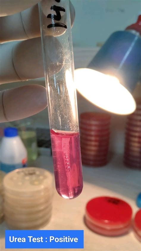Jakir Hosen On Linkedin Urea Test Positive Reaction Pink Color Of The