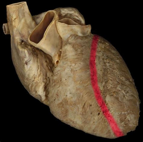 Flashcards Heart Arteries And Veins Quizlet