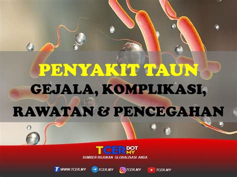 Penyakit Taun Gejalakomplikasi Rawatan Dan Juga Pencegahan Tcermy