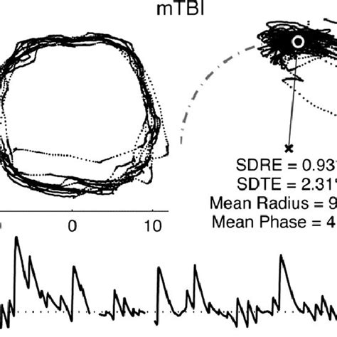 Circular Visual Tracking After Concussion Top Left Twodimensional