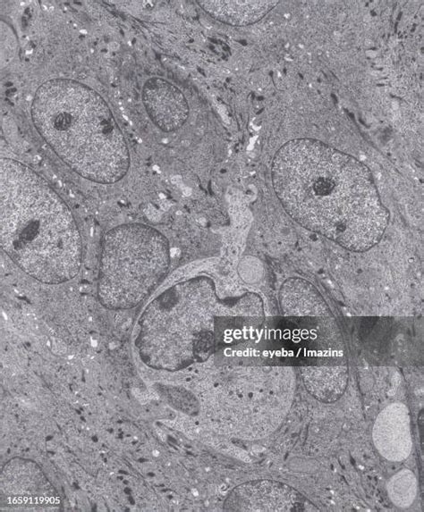 Immune Electron Microscopy Photos And Premium High Res Pictures Getty