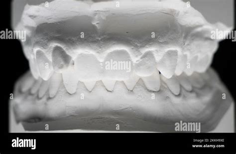 Plaster Teeth Stock Videos And Footage Hd And 4k Video Clips Alamy