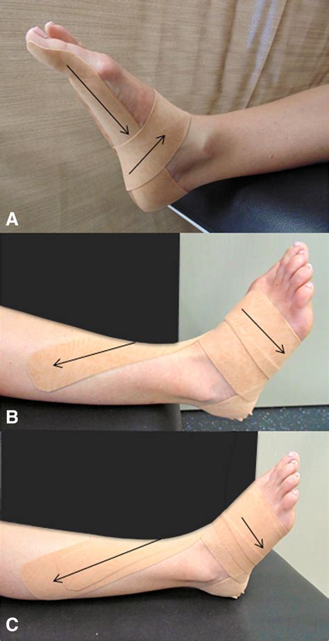 Ankle Taping Artofit
