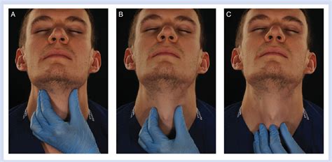 [pdf] Difficult Airway Society 2015 Guidelines For Management Of