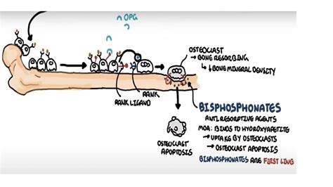Bisphosphonates Pyrophosphonate Analogues Pptx