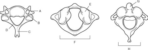 The Vertebral Column Spinal Cord And Neck Basicmedical Key