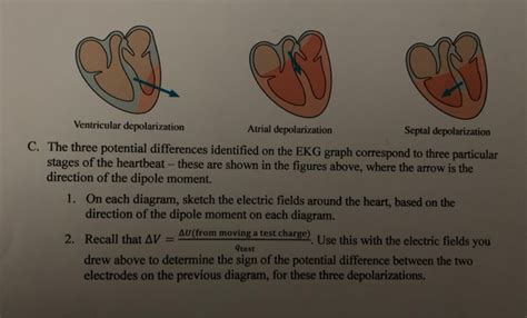 Solved Ventricular Depolarization Atrial Depolarization