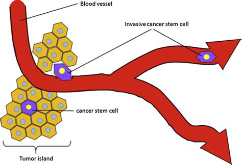 What Is Tissue Cancer At Harry Christison Blog
