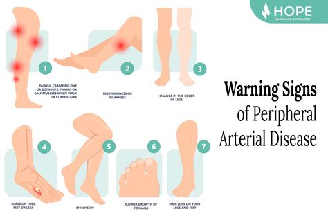 What Are The Warning Signs Of Peripheral Arterial Disease Houston