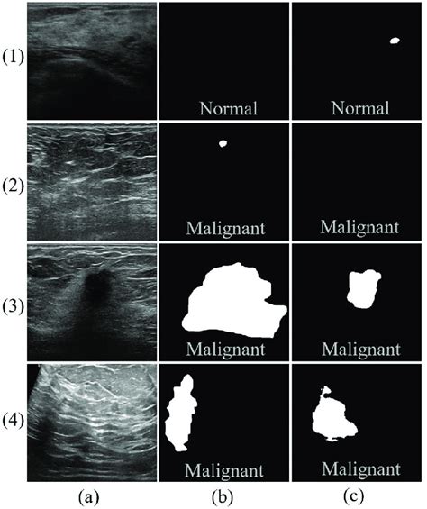 Illustration Of Segmentation Failure Examples A Bus Images B