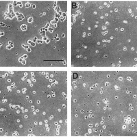 Morphological Assay Of Neuronal Pc12 Cell Survival Neuronal Pc12 Cells Download Scientific