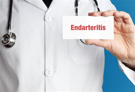 「endarteritis」の写真素材 9件の無料イラスト画像 Adobe Stock
