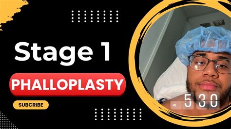 Gender Reassignment Surgery Stage 1 Phalloplasty Youtube