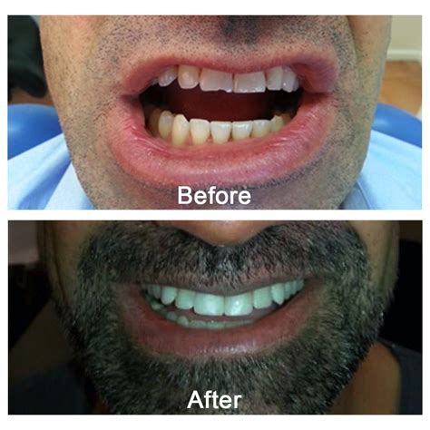 Gallery Malvern East Dental