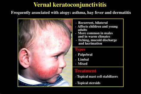 Ppt 1 Allergic Rhinoconjunctivitis Powerpoint Presentation Free Download Id 740045