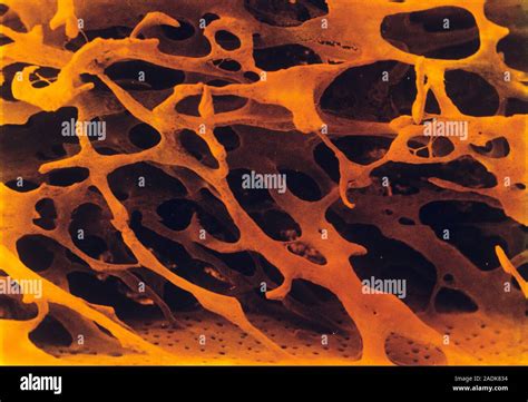 Spongy Bone Tissue Coloured Scanning Electron Micrograph Sem Spongy
