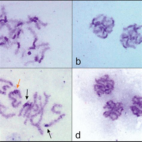 A Bn Bozdagus With Dark Heterochromatic Blocks On All Chromosomes A Download Scientific