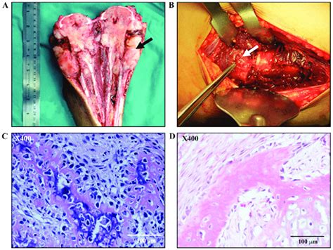 Histology Of Osteosarcoma And Soft Callus Tissues A Gross Specimen