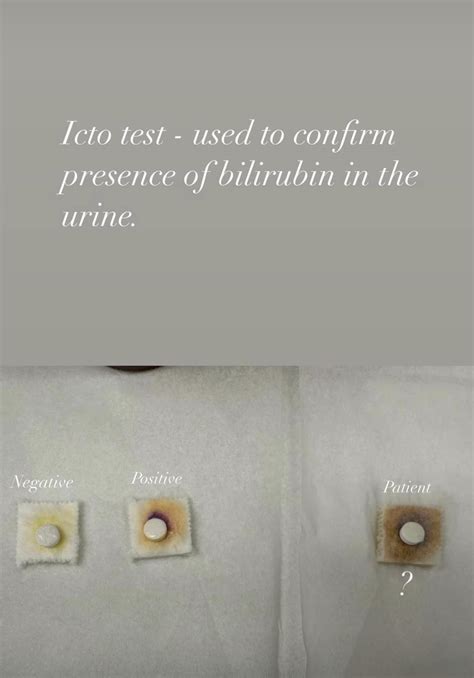 Ictotest® Reagent Tablets Are Used To Learn It By Heart