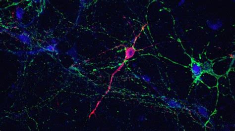 Maladie De Parkinson · Inserm La Science Pour La Santé