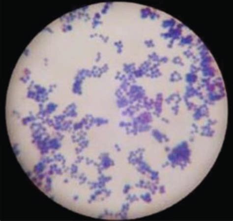 Gram Positive Rods In Clusters Gram Stain Of Gram Positive Cocci And