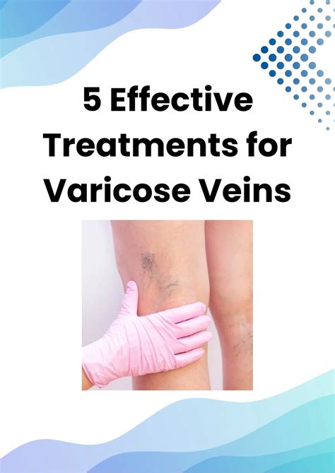 Ppt 5 Effective Treatments For Varicose Veins Powerpoint Presentation