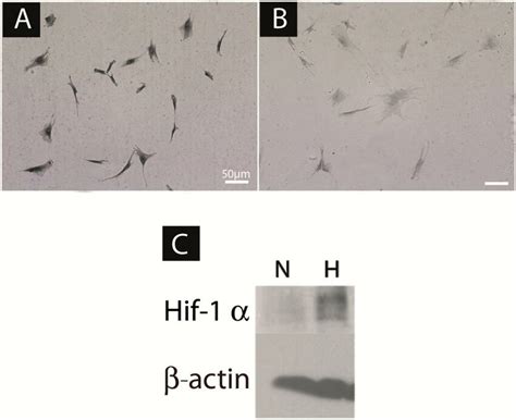 Confirmation Of Cellular Hypoxia Cells Were Cultured On Glass Slides