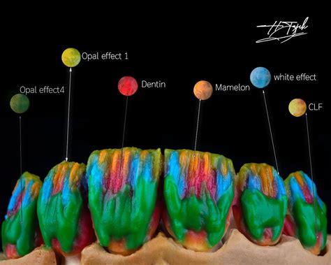 Hadi Tajik Dental Technician Emax Layering 💫