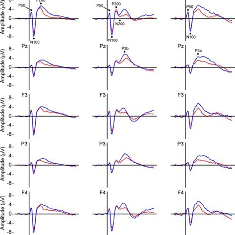 Grand Average Erps For Standard Target And Distractor Stimuli In Mild