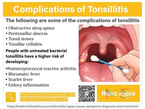 Complications Of Tonsillitis — More Than Just A Sore Throat